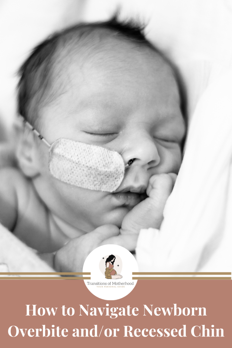 Navigating A Newborn Overbite and/or Recessed Chin - ToM